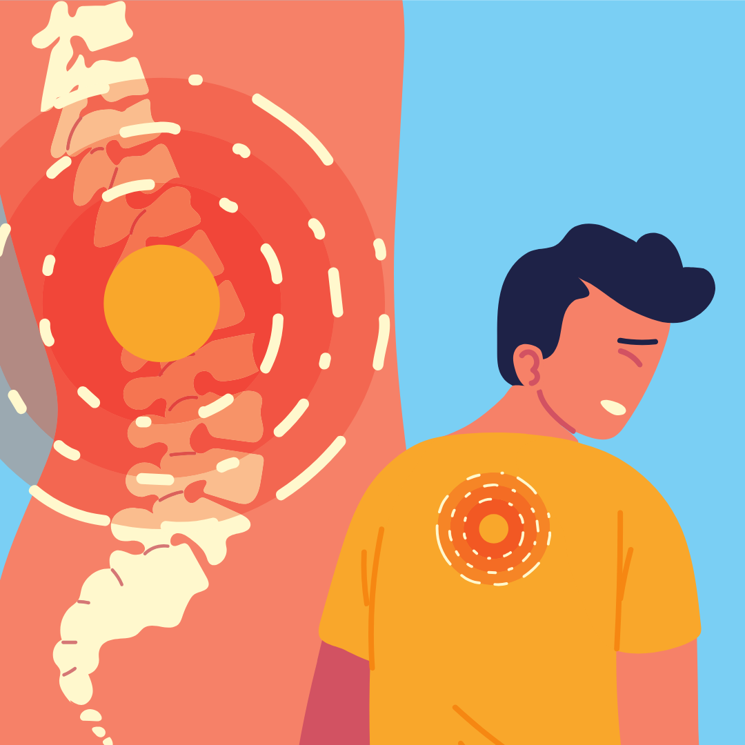 إصابات رياضة كمال الاجسام - Contenteen